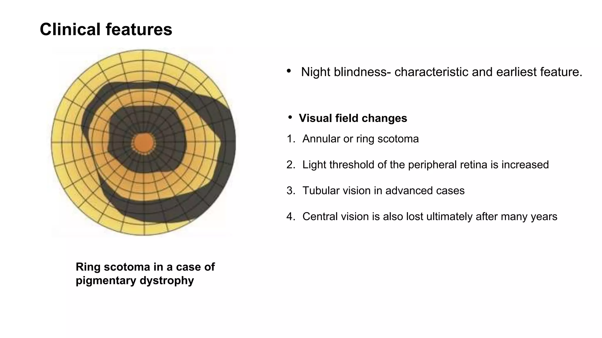 Retinitis Pigmentosa | PPTX | Eye and Vision Conditions | Diseases and ...