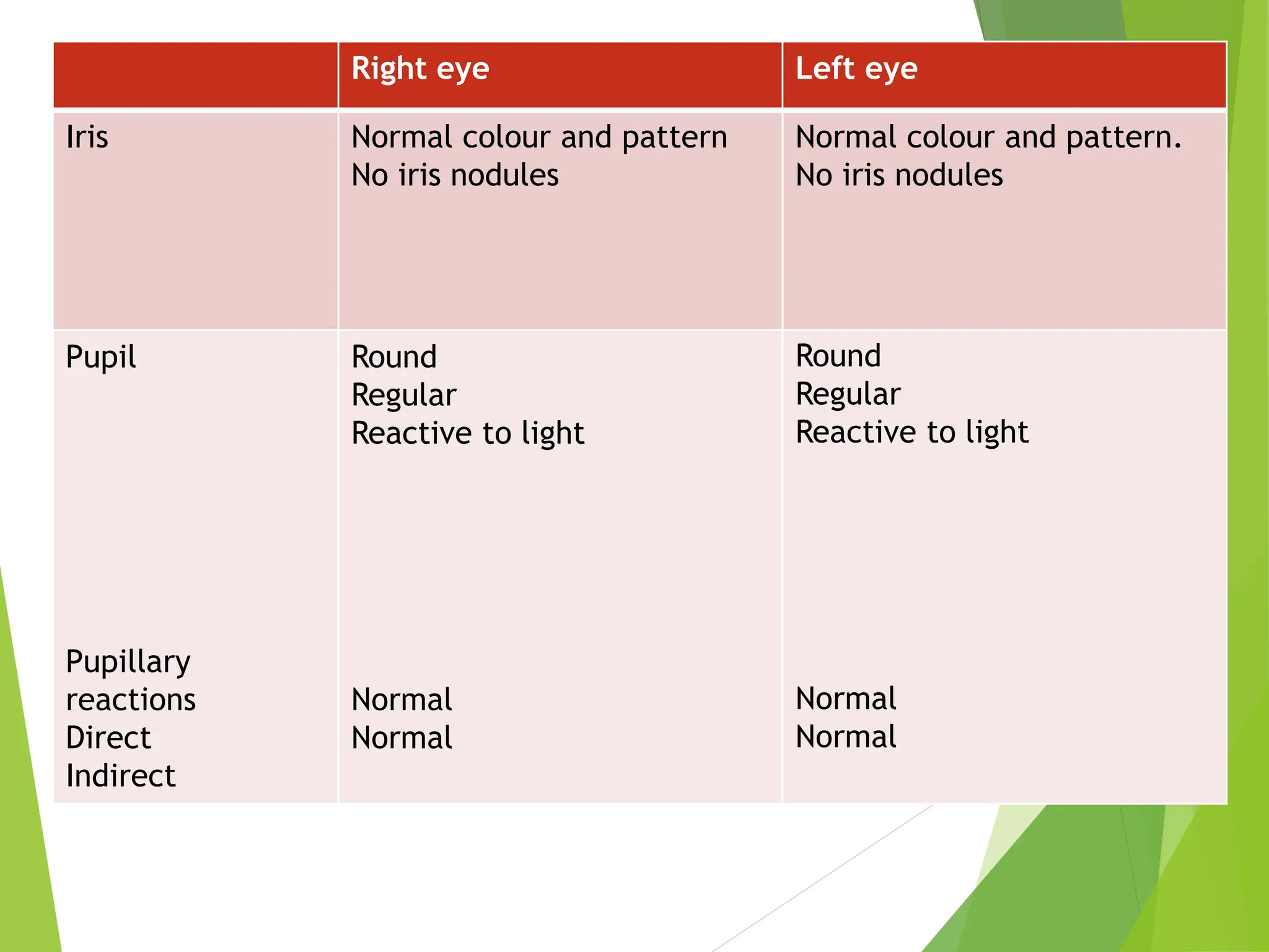 RETINITIS PIGMENTOSA.pptx