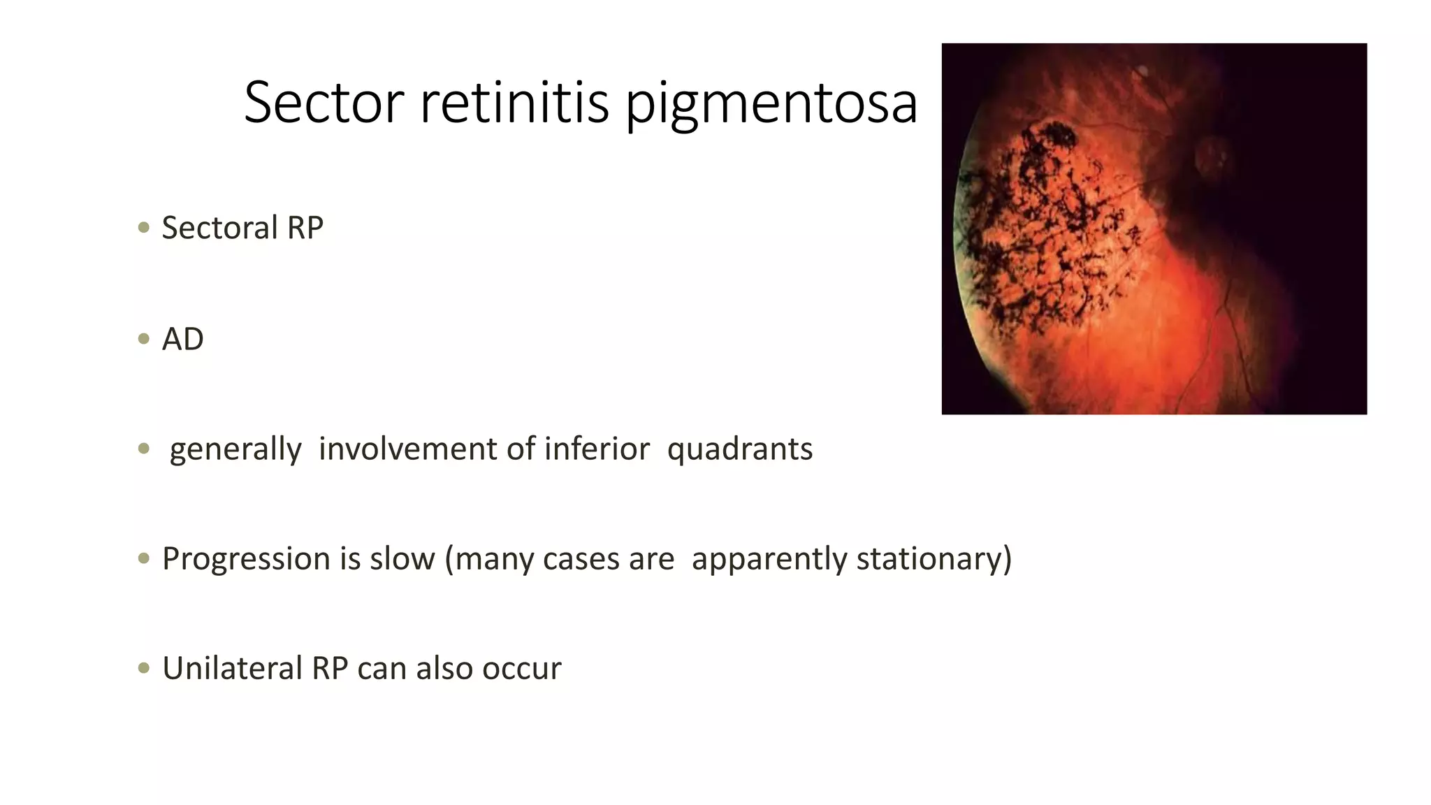 Retinitis pigmentosa and allied disorders | PPTX | Eye and Vision ...