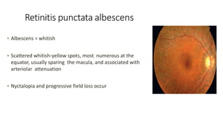 Retinitis pigmentosa and allied disorders | PPTX