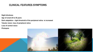 Retinitis Pigmentosa and vitreous by Dr H N Sowbhagya.pptx