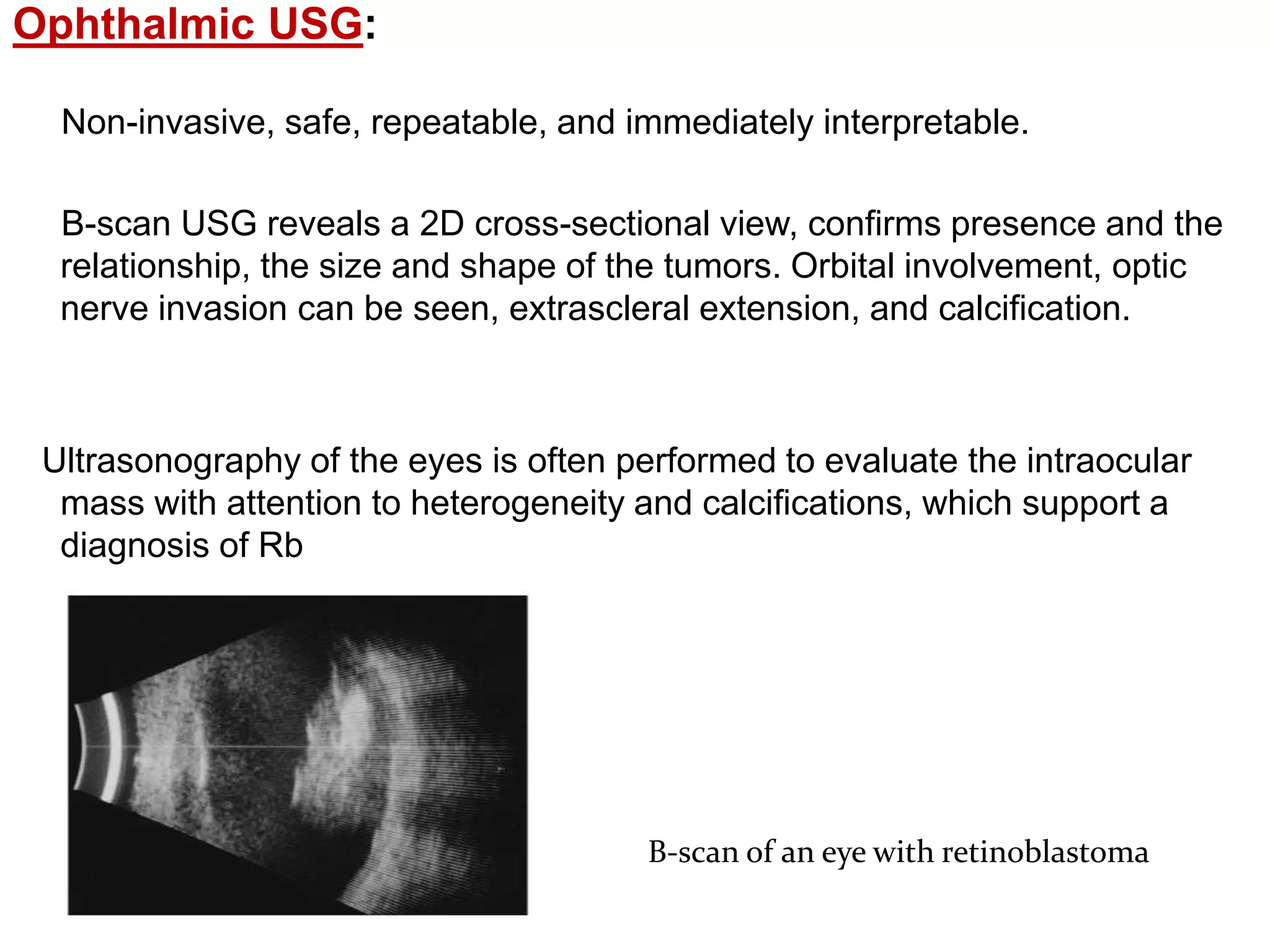 Retinoblastoma | PPTX