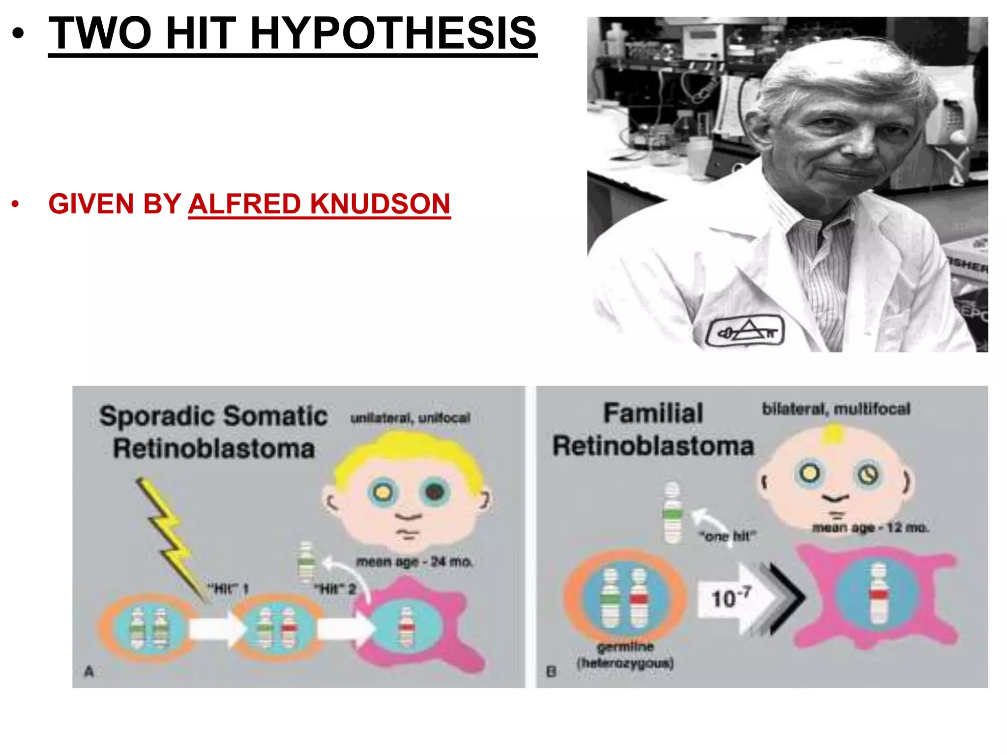 Retinoblastoma | PPTX
