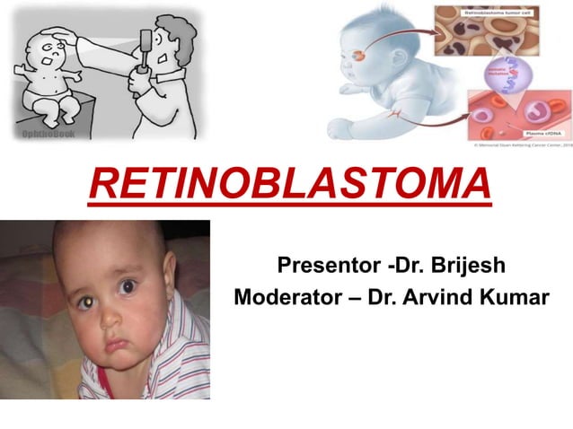 Retinoblastoma | PPTX | Eye and Vision Conditions | Diseases and Conditions