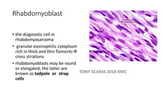 Retinoblastoma revision notes | PPT