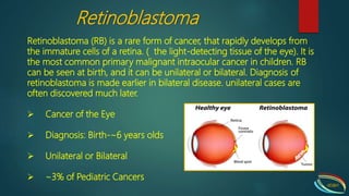 Retinoblastoma | PPTX