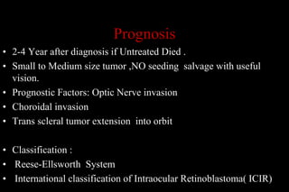 Retinoblastoma | PPT