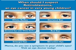 Retinoblastoma | PPT