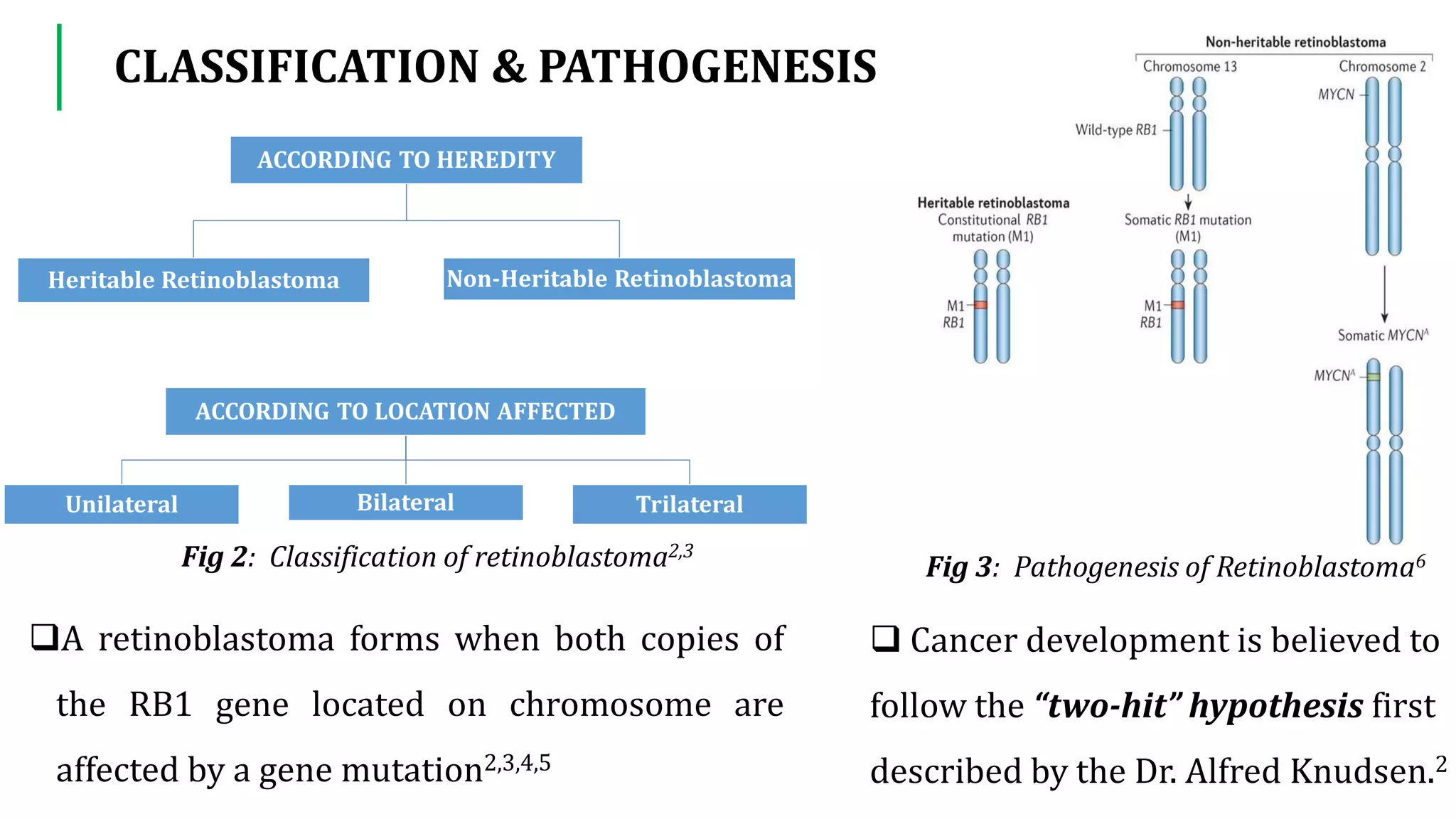 RETINOBLASTOMA 3.pdf