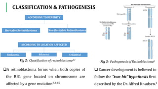 RETINOBLASTOMA 3.pdf