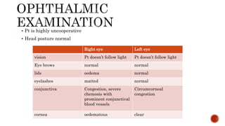 Retinoblastoma BE- case presentation | PPTX | Eye and Vision Conditions ...