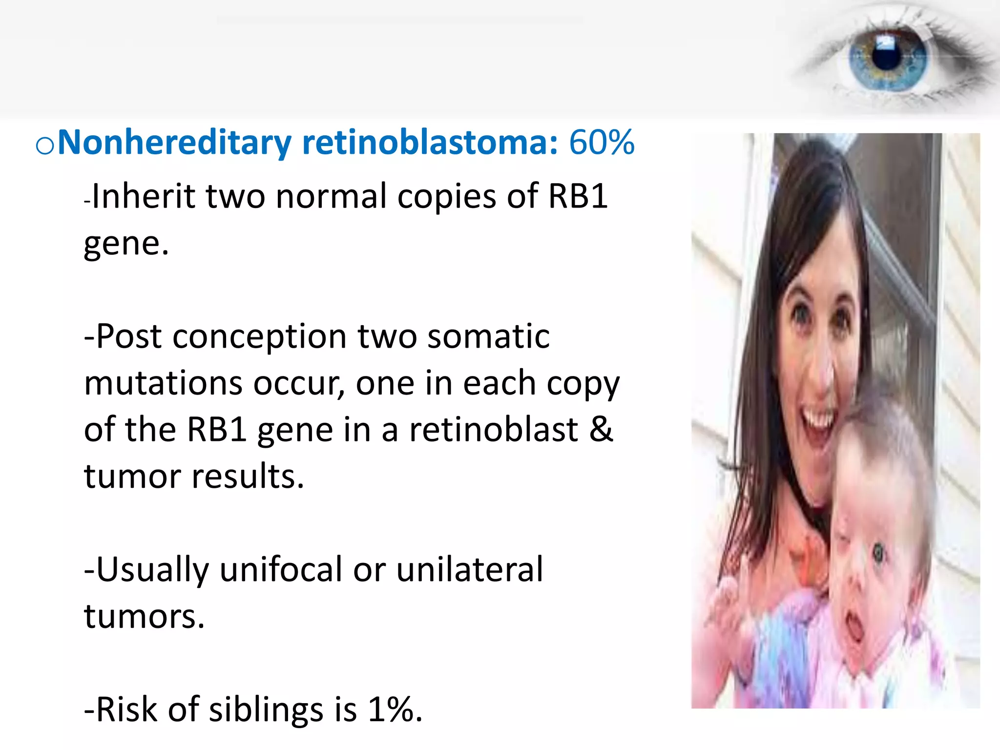 Retinoblastoma | PPTX