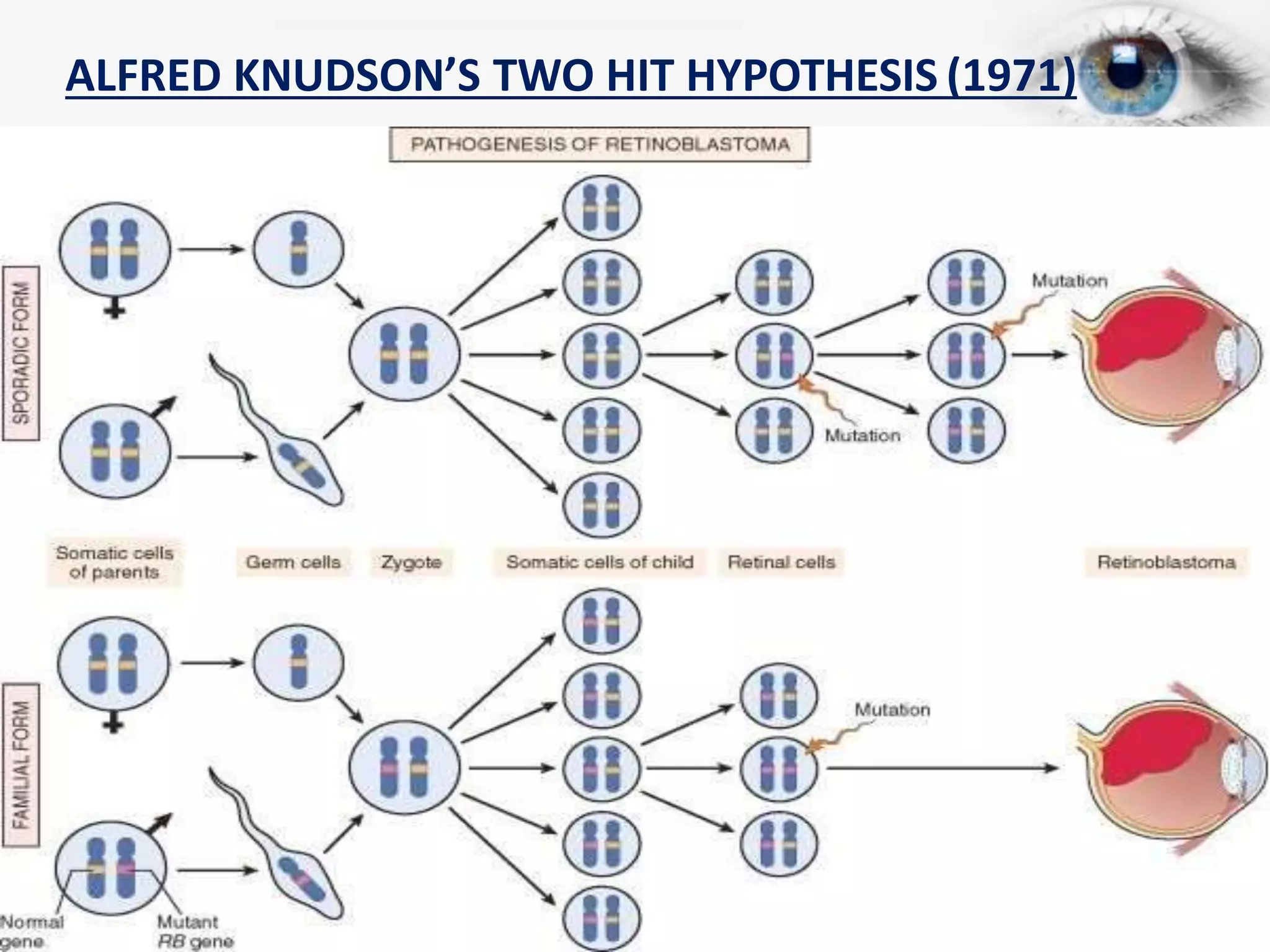 Retinoblastoma | PPTX