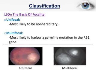 Retinoblastoma | PPTX