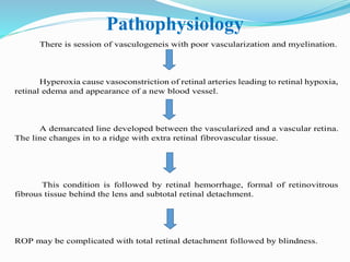 Retinopathy of Prematurity | PDF