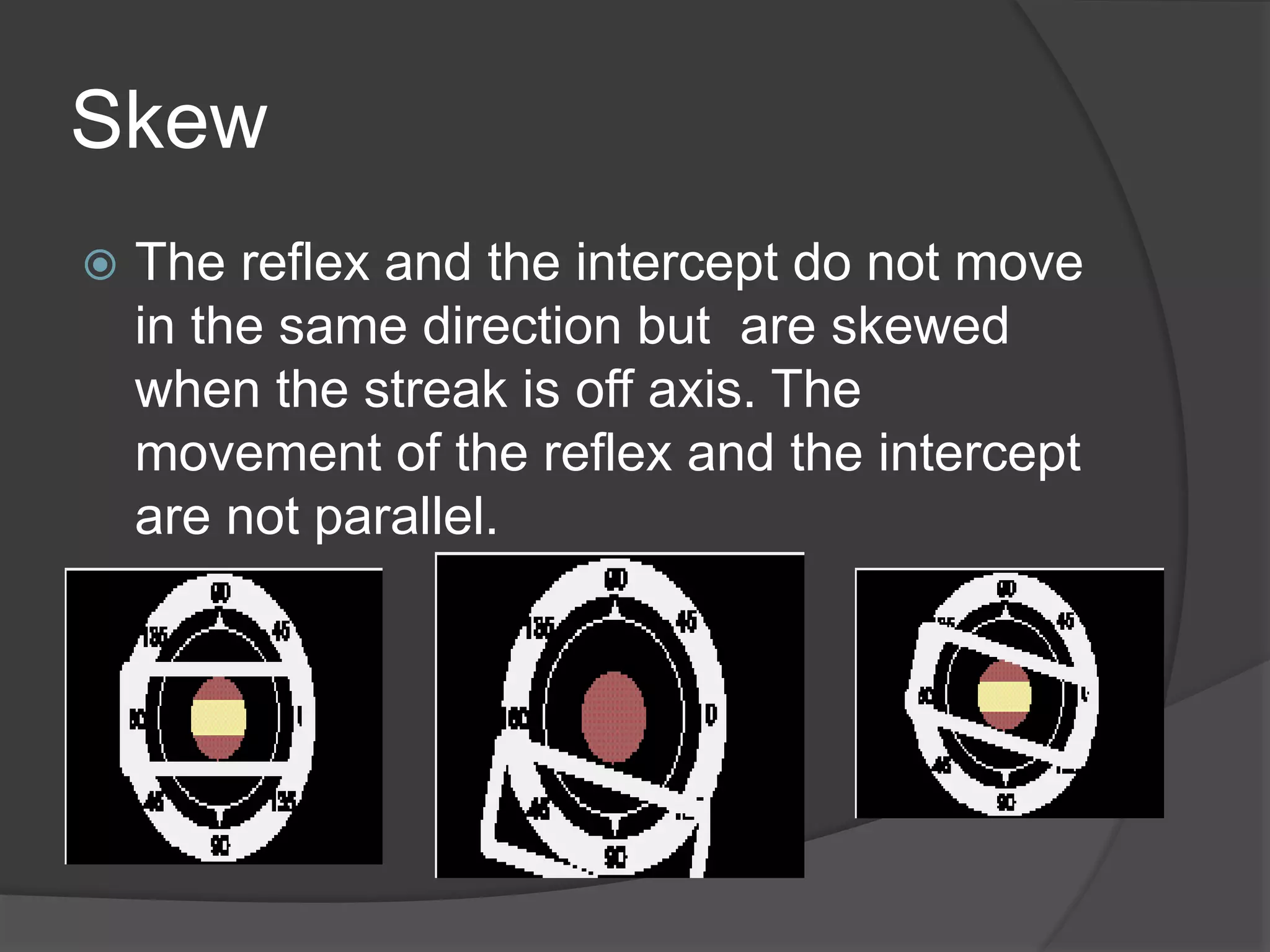 Retinoscopy For Astigmatism | PPTX