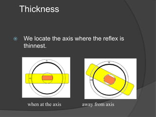 Retinoscopy For Astigmatism | PPTX