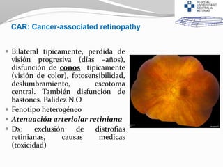 Retinopatía autoinmune | PPTX