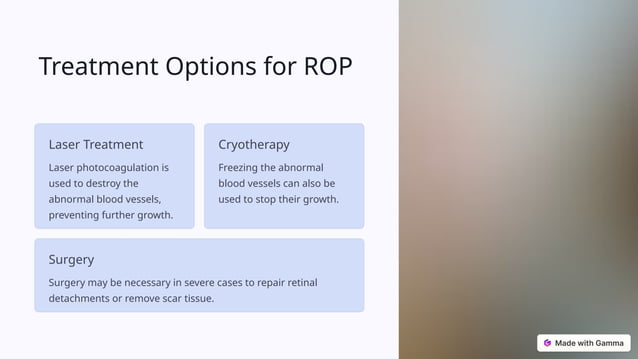 Retinopathy-of-Prematurity-ROP.pptx pptt | PPT