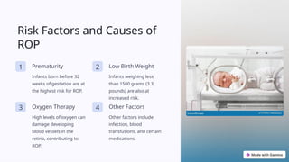 Retinopathy-of-Prematurity-ROP.pptx pptt | PPT
