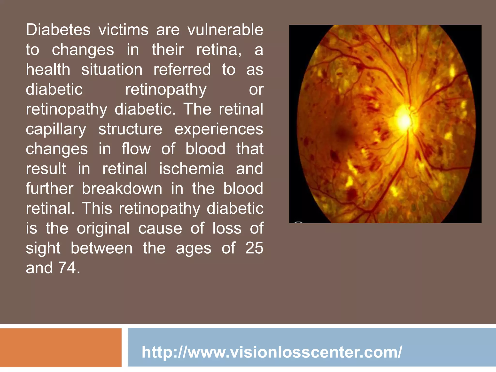 Retinopathy diabetic | PPTX | Eye and Vision Conditions | Diseases and ...