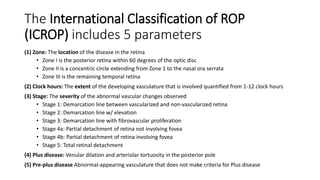 Retinopathy of prematurity | PPTX