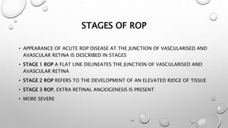 Retinopathy of prematurity | PPT