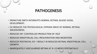Retinopathy of prematurity | PPT