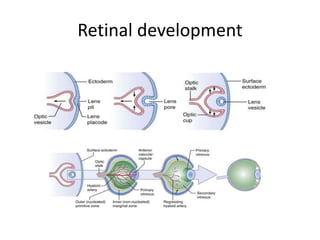 Retinopathy of prematurity | PPTX