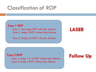 Retinopathy of prematurity | PDF