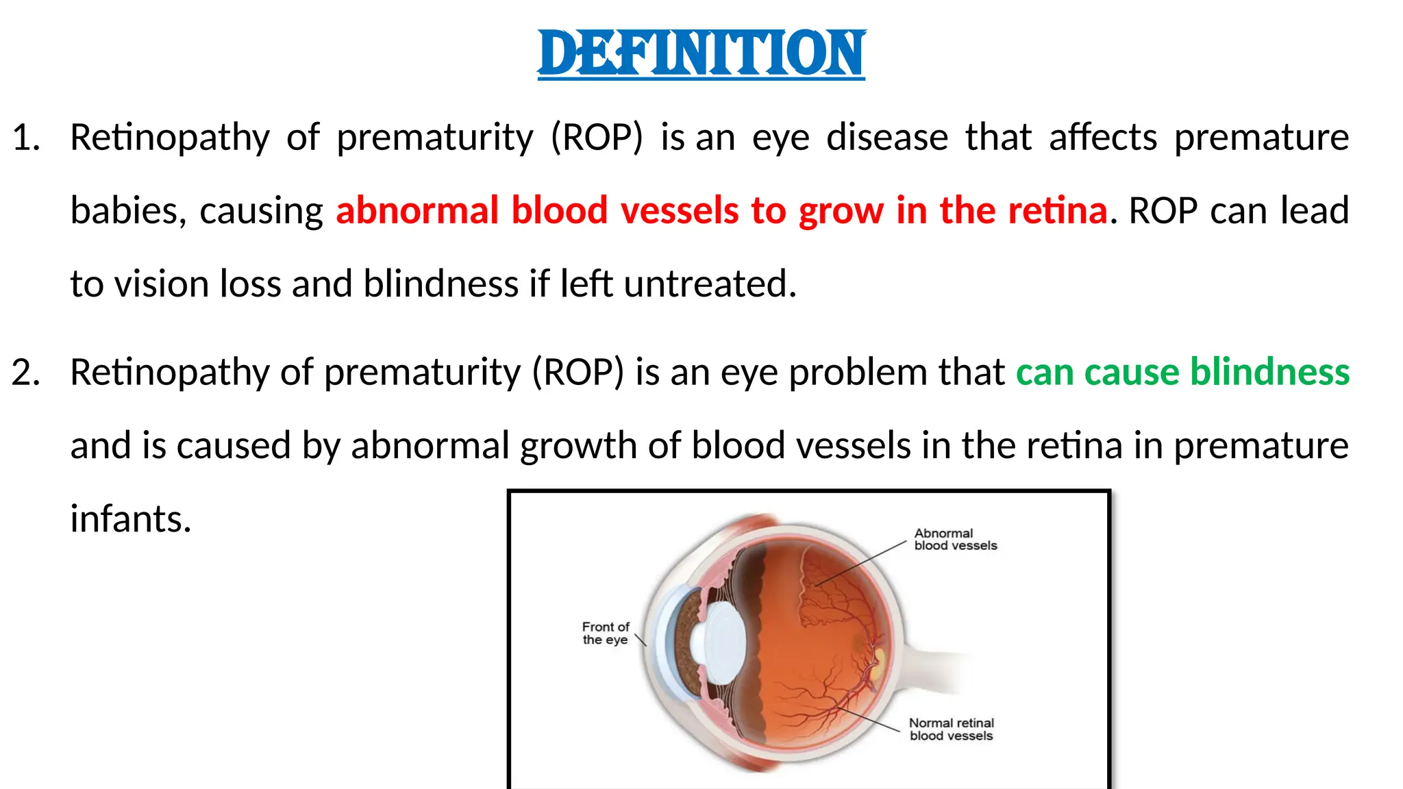 retinopathy of prematurity/ ROP .pptx