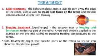 retinopathy of prematurity / ROP .pptx