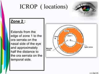 Retinopathy of prematurity by dr sonali paradhi mhatre | PPSX