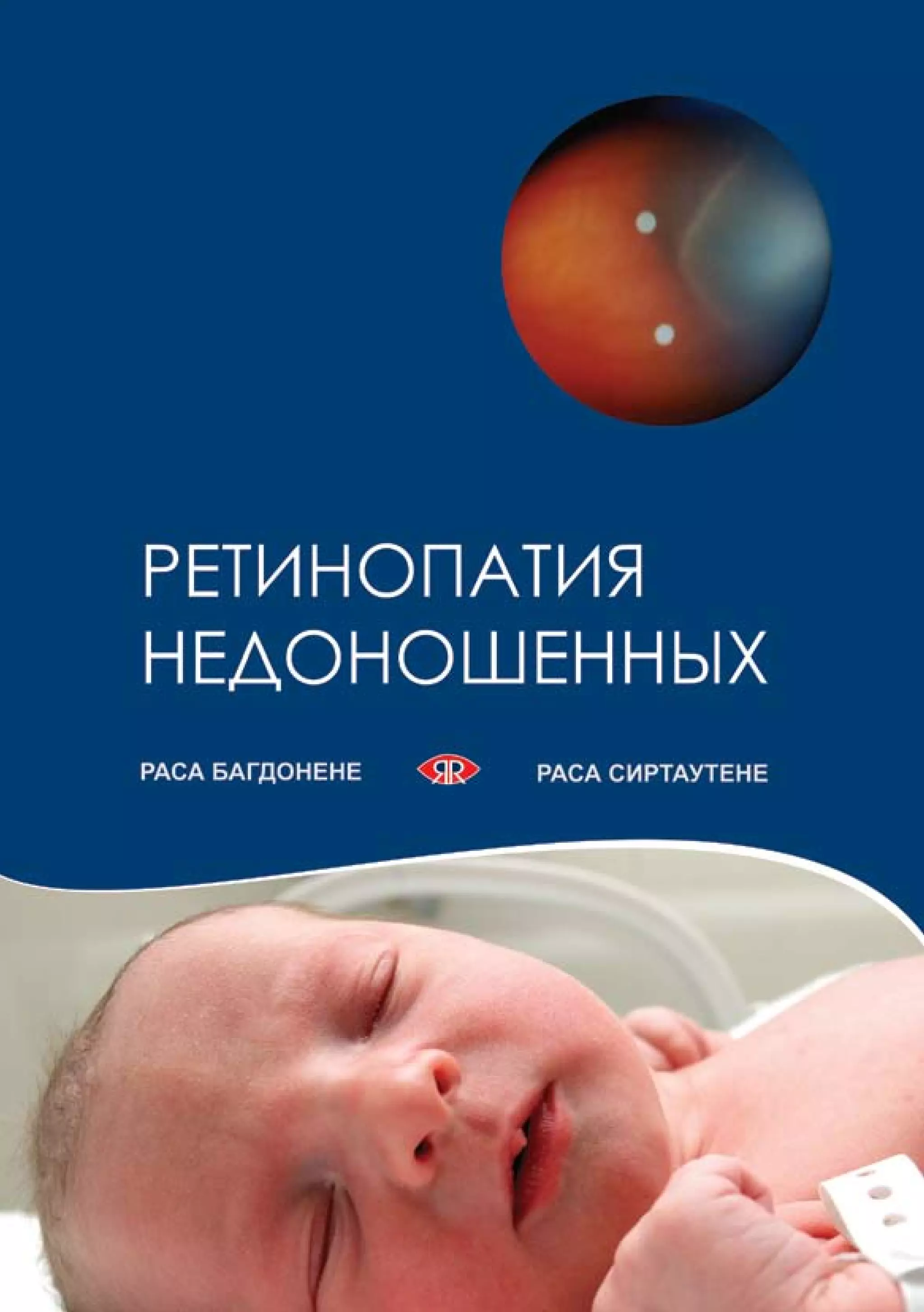 Retinopathy Of Prematurity, Guidelines, Ru[1] Doc | PDF
