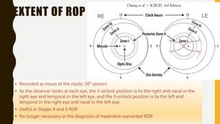 Retinopathy of Prematurity (ROP).pptx slides | PPTX