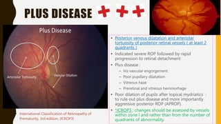 Retinopathy of Prematurity (ROP).pptx slides | PPTX