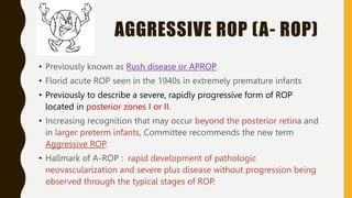Retinopathy of Prematurity (ROP).pptx slides | PPTX