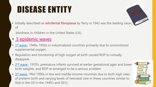 Retinopathy of Prematurity (ROP).pptx slides | PPTX
