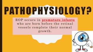 Retinopathy of Prematurity (ROP).pptx slides | PPTX