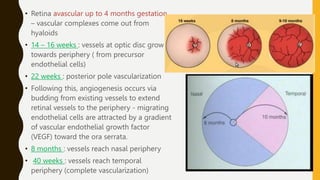 Retinopathy of Prematurity (ROP).pptx slides | PPTX