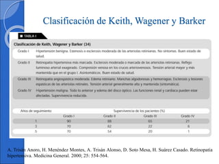 Retinopatía Hipertensiva.ppt