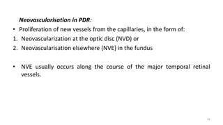 Diabetic Retinopathy | PPTX