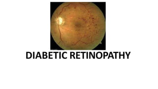 retinopatrhydiabetic-211003134714 (2).pptx