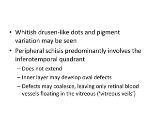 Retinoschisis | PPT