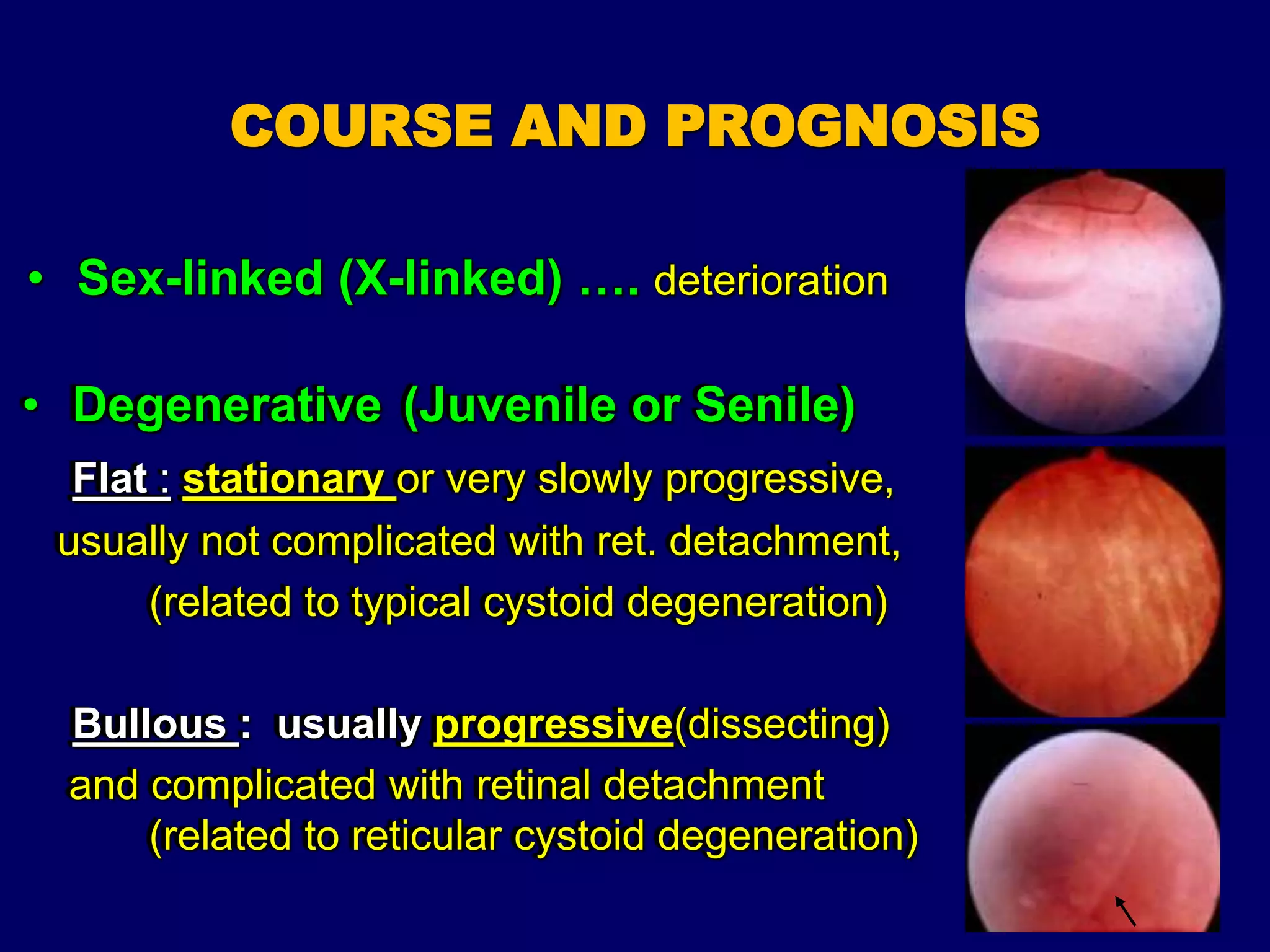 RETINOSCHISIS AND RETINAL DETACHMENT | PPT