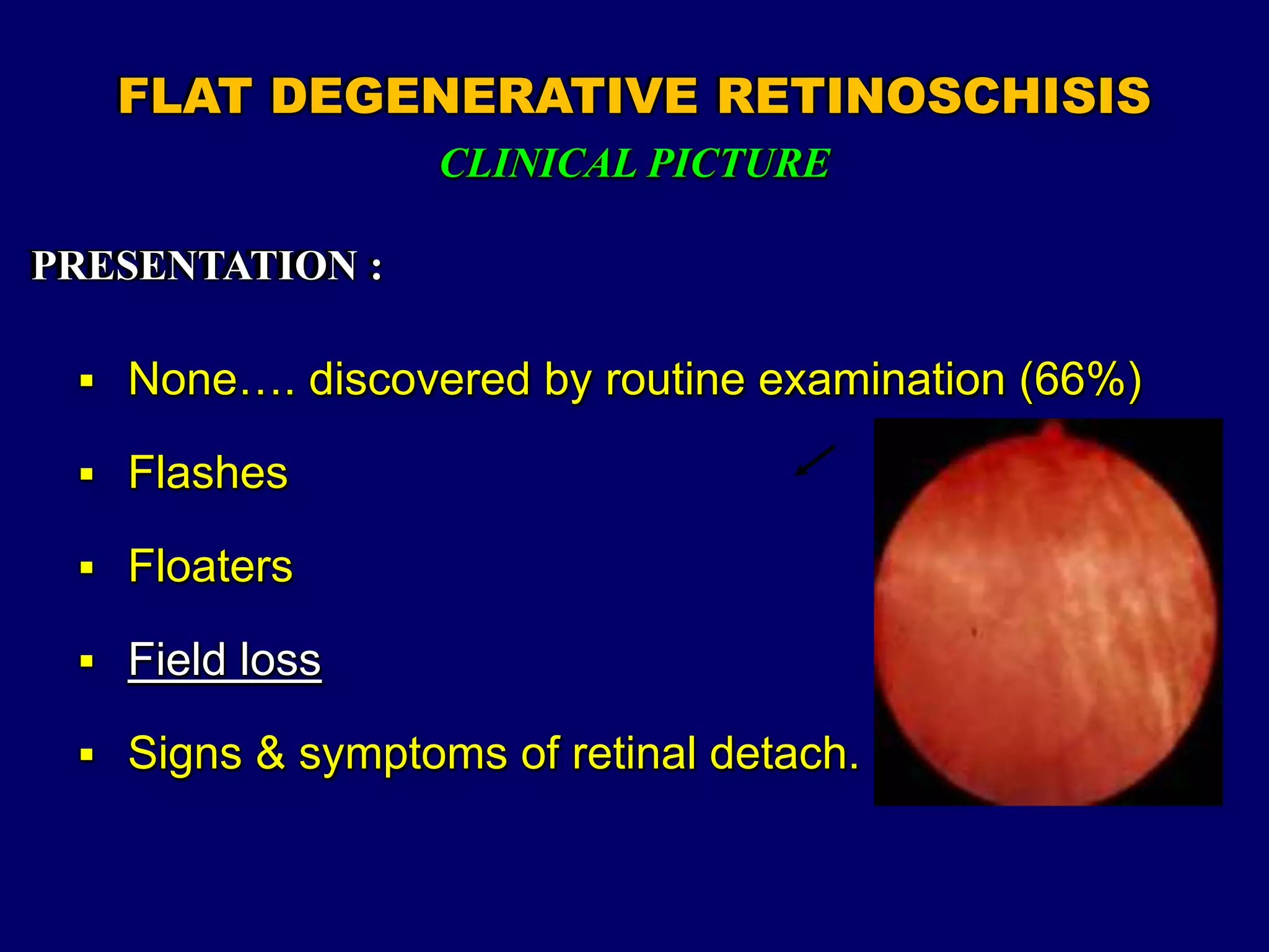 RETINOSCHISIS AND RETINAL DETACHMENT | PPT