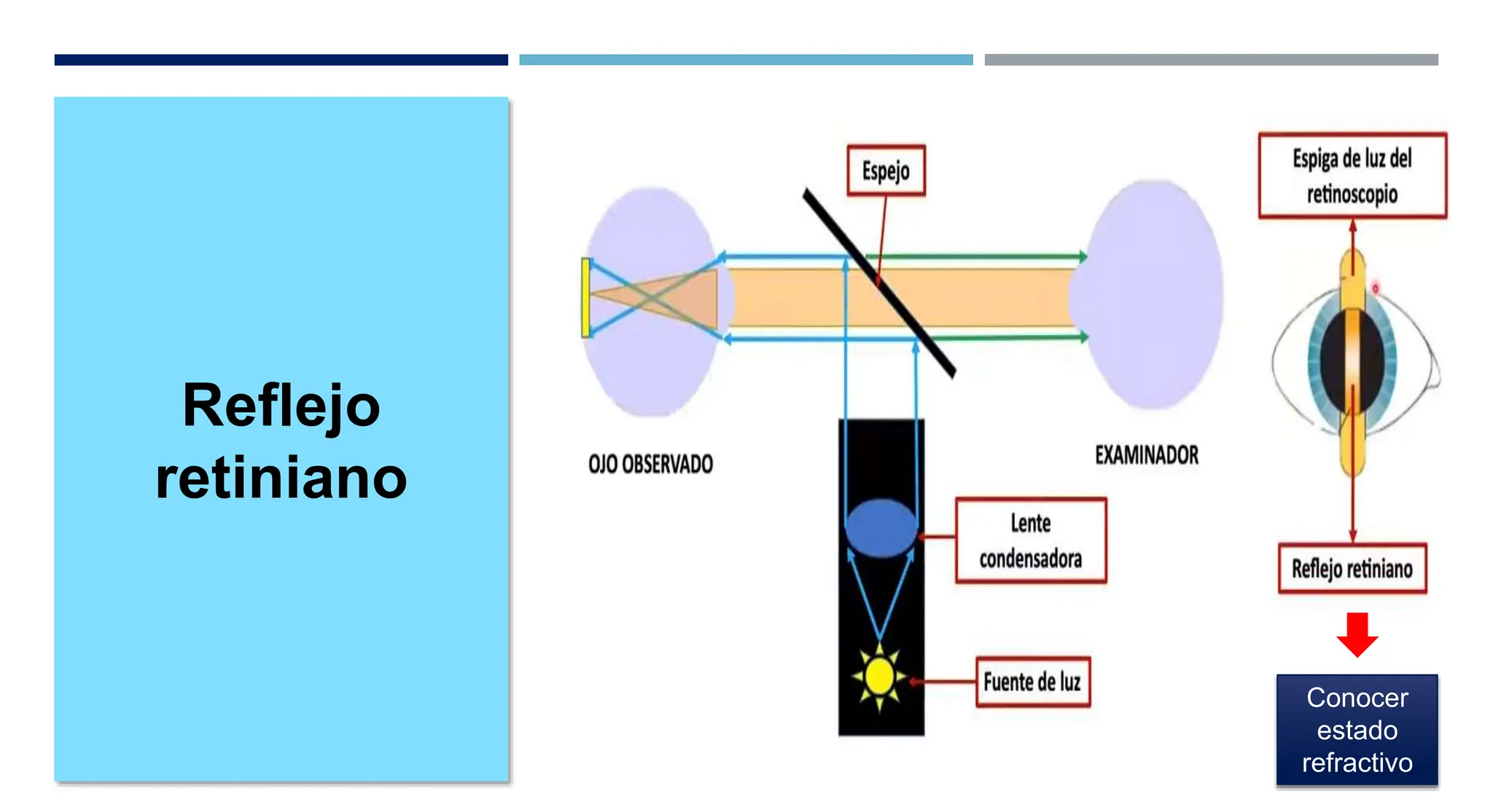 Retinoscopía y Esquiascopia pediatrica.pptx