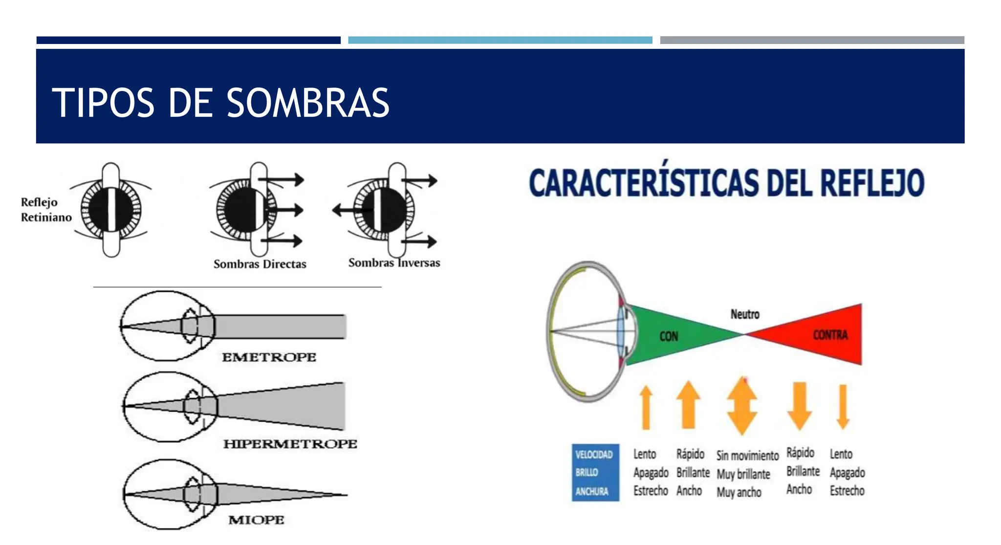Retinoscopía y Esquiascopia pediatrica.pptx