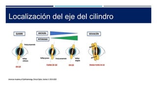 Retinoscopía y Esquiascopia pediatrica.pptx