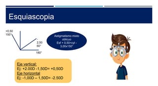 Retinoscopía y Esquiascopia pediatrica.pptx